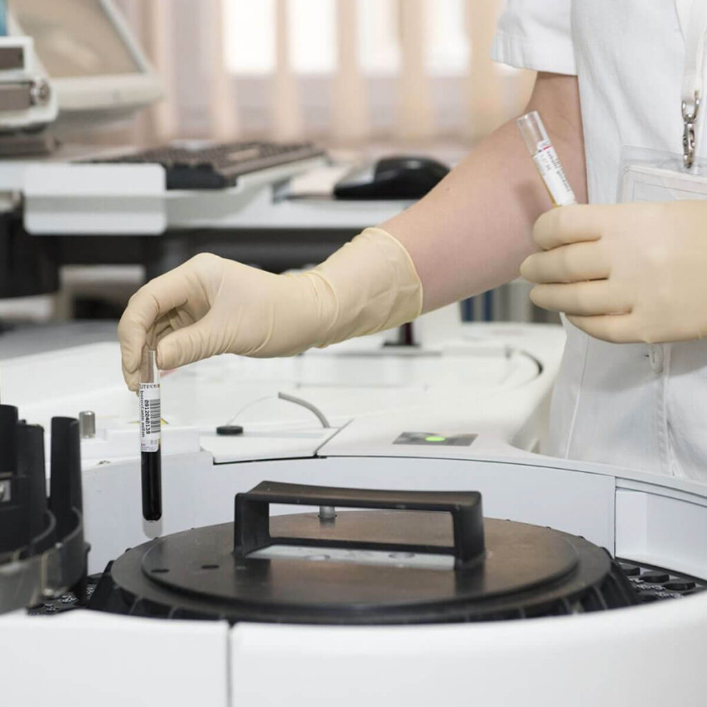 SIEMENS Immulite 1000 IMMUNOLOGY ANALYZER – Innolab